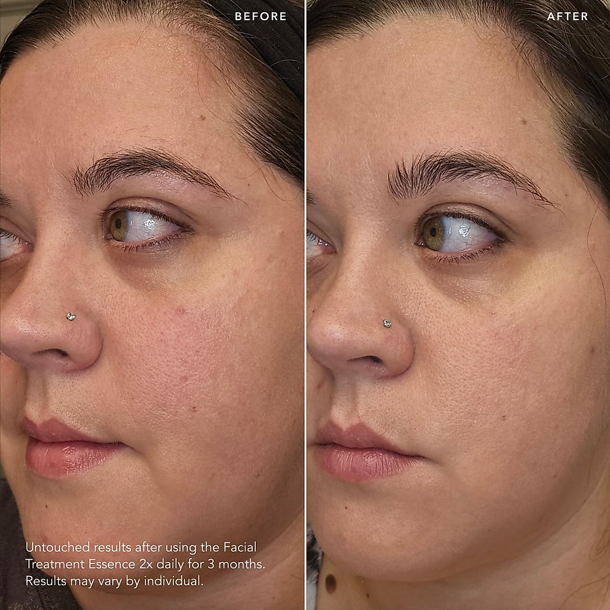 SK-II Facial Treatment Essence - Anti-Aging Essence Skincare to Help Reduce the Appearance of Fine Lines & Wrinkles - Visibly Refines Texture & Improves Firmness & Dark Spots (11.2 oz)