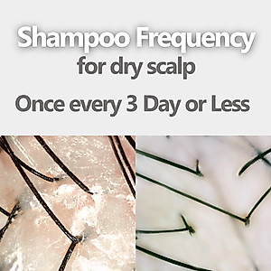 Aromase Soothing Shampoo for Dry, Itchy, and Flaky Scalps – designed to relieve scalp itchiness and provide lasting comfort gently.