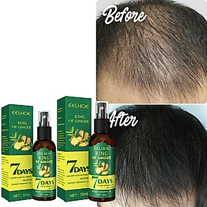 Ginger Germinal Oil, 7 Days Ginger Hair Growth Spray Serum Anti Hair Loss Products Fast Grow Prevent Hair Oil Dry Damaged Thinning Repair Care for Women & Men (50ml)