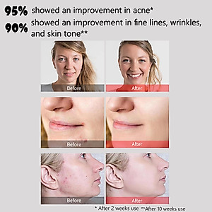 Aphrona Led Face Mask Light Therapy, Halo Led Light Therapy Facial and Neck Skin Care Mask, Blue Light Red Light for Acne Wrinkle Reduce, New Generation Face and Neck Photon Mask