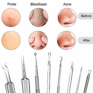 Fluco Blackhead Remover Pimple Popper Tool Kit, 8pcs Blackhead Comedone Extractor Tool for Nose Face, Blemish Whitehead Extraction Popping, Stainless Silver