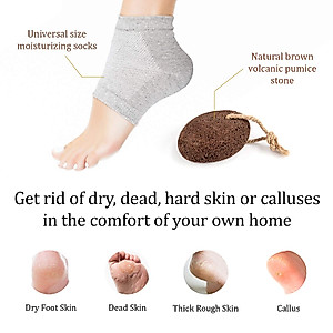 Pumice Stone for Feet & Moisturizing Heel Sleeves - Natural Lava Foot Stone Callus Removing Set - Cracked Heel Treatment - Foot Care Kit for Dry Cracked Feet Body Hands