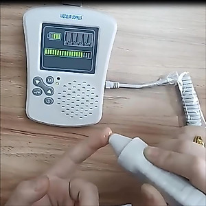8Mhz Probe Handheld Doppler Blood Flow Rate Speed Monitor、Blood Flow Strength Detector、Detect arterial/venous Blood Flow Status and Average Blood Flow Velocity
