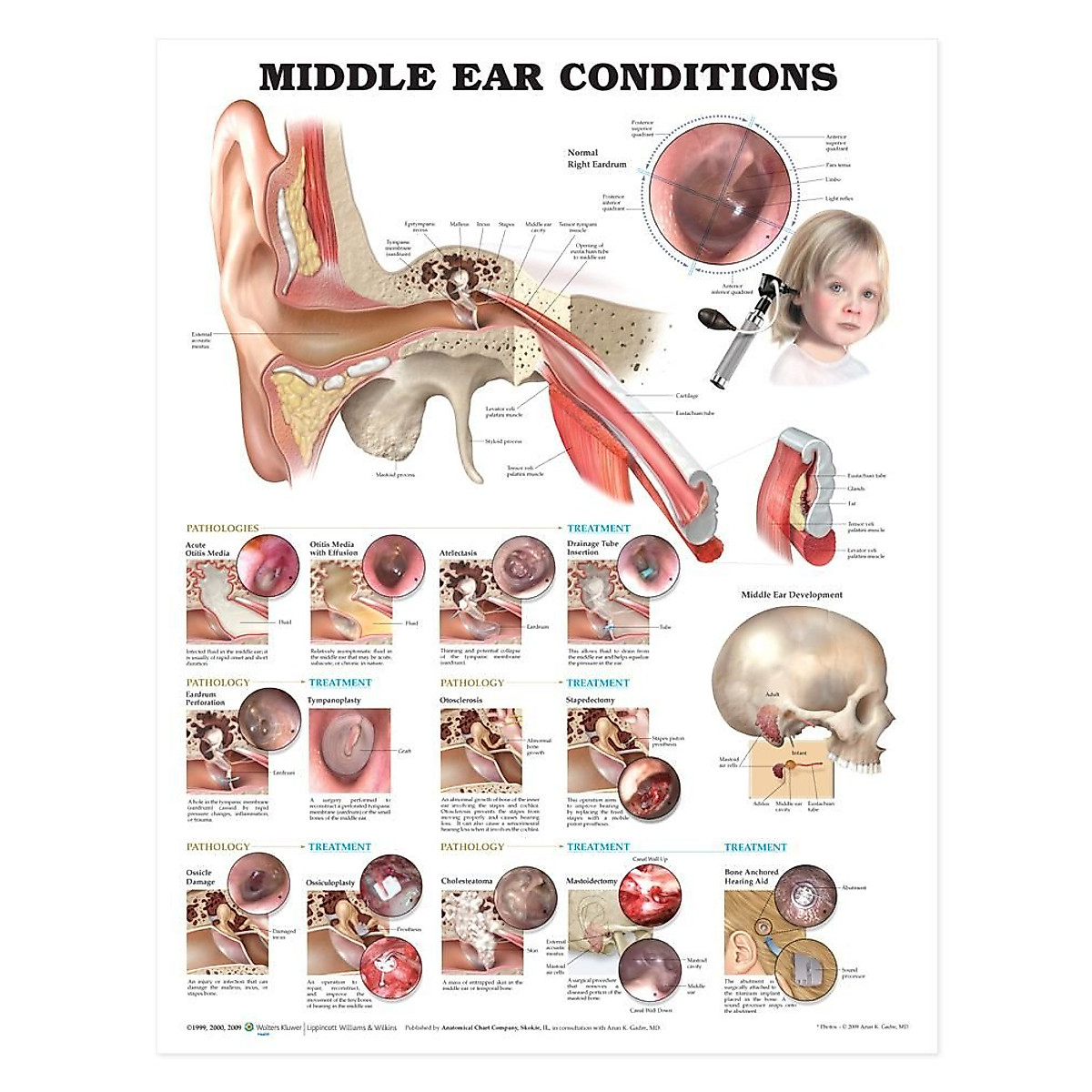 Middle Ear Conditions Anatomical Chart