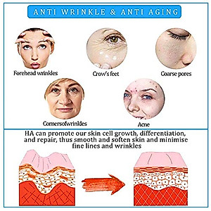 Luxsea Salicylic Acid 2% Solution Face Serum Shrink Pores Hyaluronic Acid Serum Gentle Exfoliating for Smoother & Clearer Skin, Treats Rosacea, Blackheads, Clogged Pores, Dullness, Oily Acne Skin