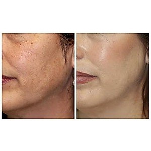 Mary Kay Timewise Microdermabrasion Plus Set