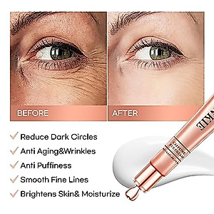 RONKIE Eye Cream for Dark Circles and Puffiness: Caffeine - Retinol Cream- Anti Aging Wrinkles With Collagen Hyaluronic Acid Fine Lines Depuffer in 3-4 Weeks-15 mL