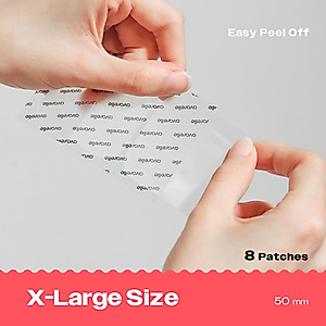 AVARELLE Acne Patches XL, FSA HSA Acne Patch Large | Pimple Patches for Face Cheek & Nose (8 Count) | Large Hydrocolloid Acne Treatment with Tea Tree, Calendula, & Cica by ZITOUT™