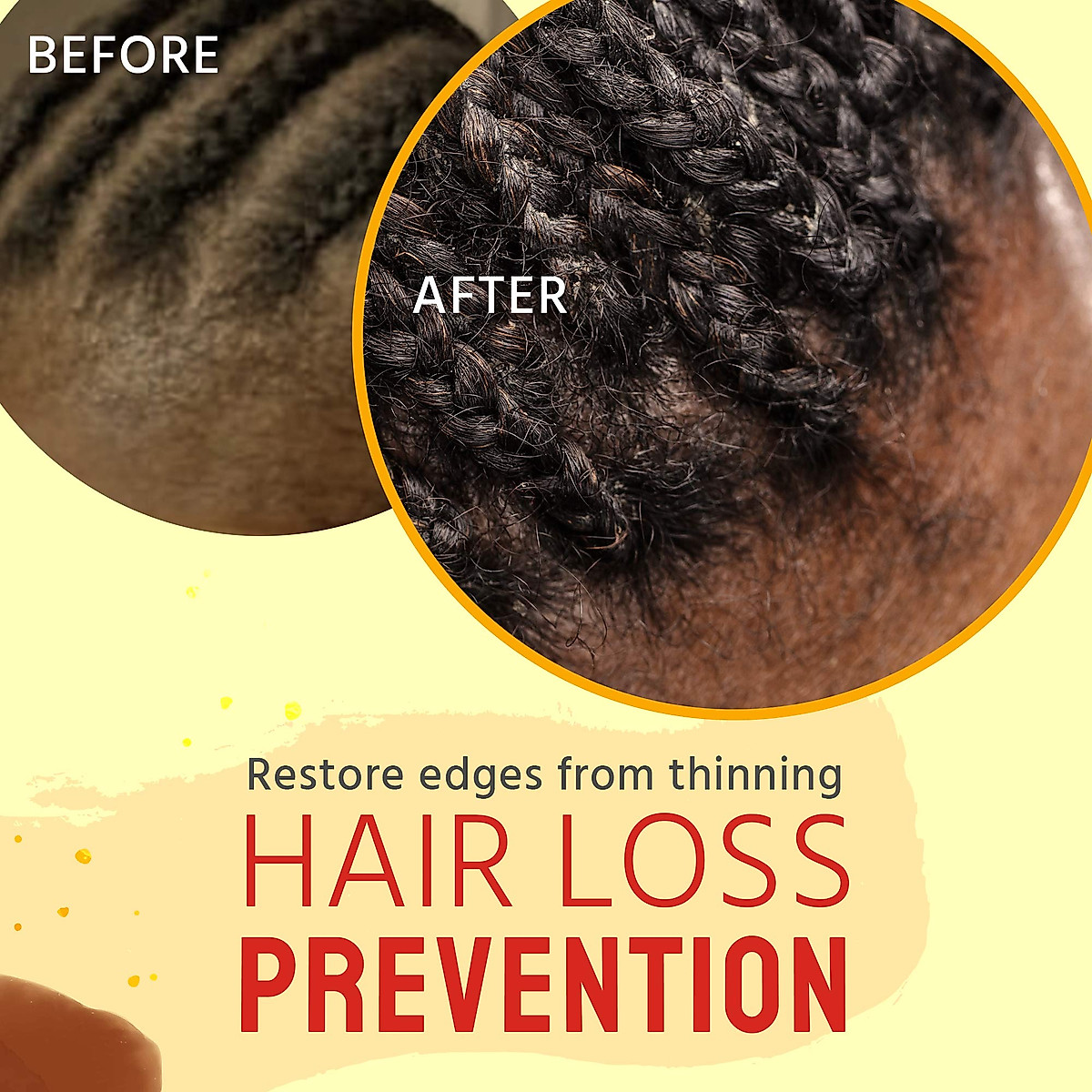 Glammed naturally oil - Braid Oil, Braid Oil for Itchy Scalp and Dry Scalp, Braid Care Oil for Dandruff, Lice and Thinning Edges, 2 Oz