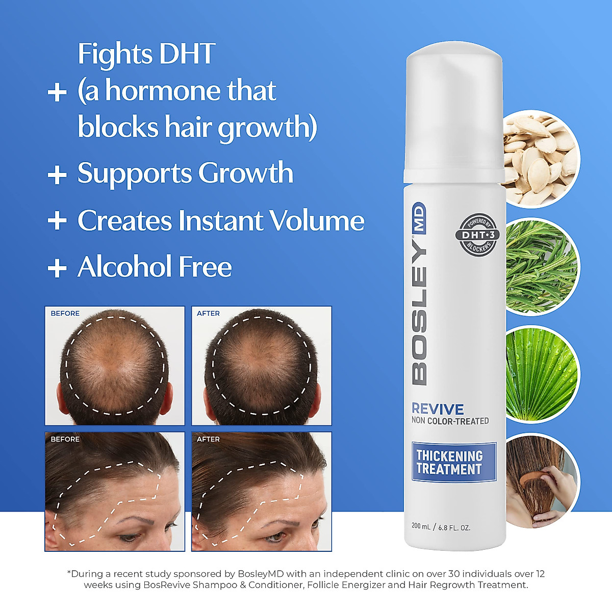 BosleyMD BosRevive Thickening Treatment for Noticeably Thinning Hair (Non Color-Treated Hair), 6.8 Fl Oz (Pack of 1)