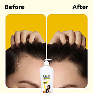 Chik Hairfall Prevent Egg Shampoo, 340ml