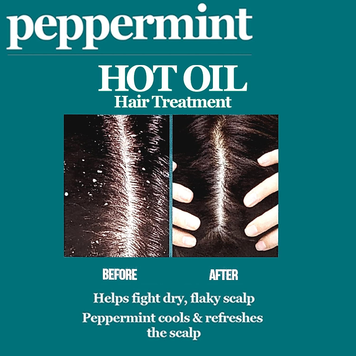 Difeel Peppermint Hot Oil Treatment for Dry, Irritated or Flaky Scalp - 7.1 oz Hair Treatment