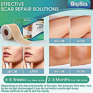 (1.6" x 150" Roll-3.8M) Professional Silicone Scar Sheets - Scars Removal Treatment - Reusable Silicone Scar Strips Type for Keloid, C-Section, Surgery, Burn, Acne et