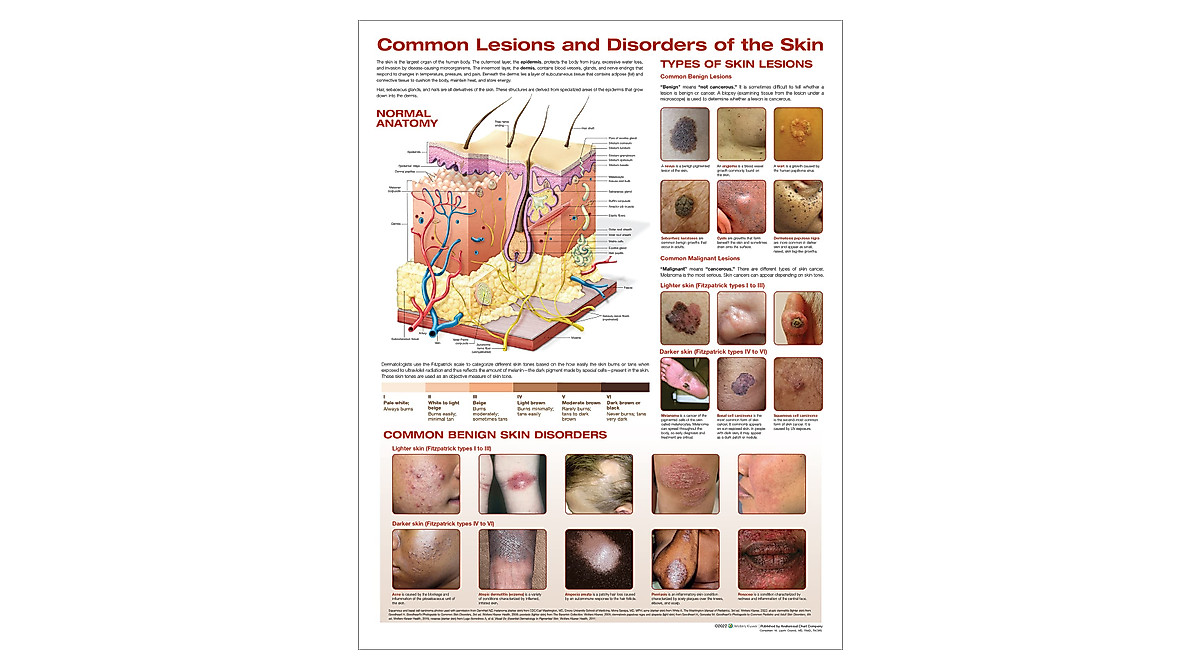 Skin & Skin Disorders Chart | Anatomical Chart Co.