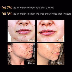 Aphrona FDA cleared LED Facial Skin Care Mask MOONLIGHT PRO 7 Color Treatment Photon Mask (White)