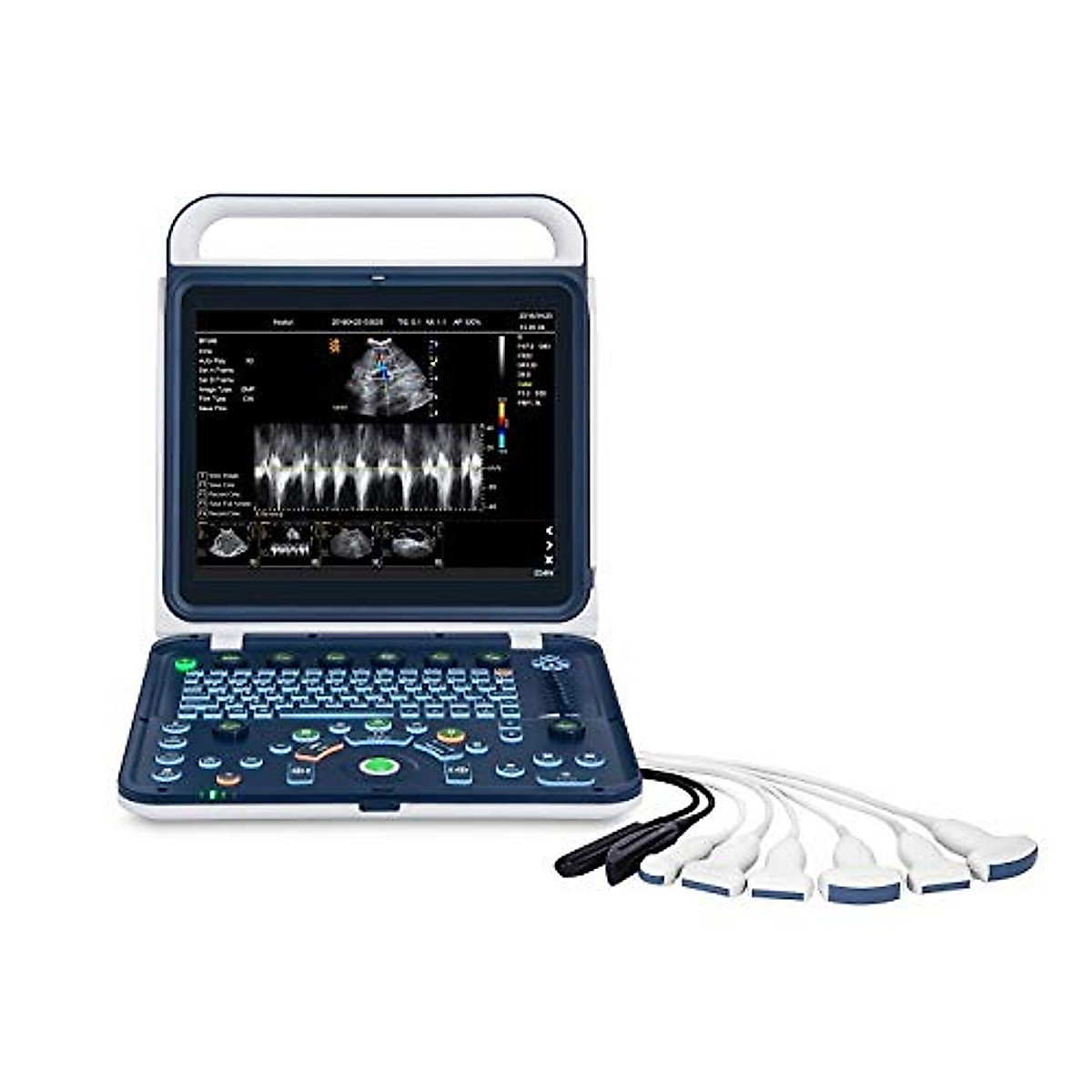 BPU60V Hand-Carried 15" Color Doppler Ultrasound System equine, large animal, small animal, zoo mammal, and marine mammal medicine body scans Abdomen, Reproduction, Gynecology, Cardiology, Small Parts