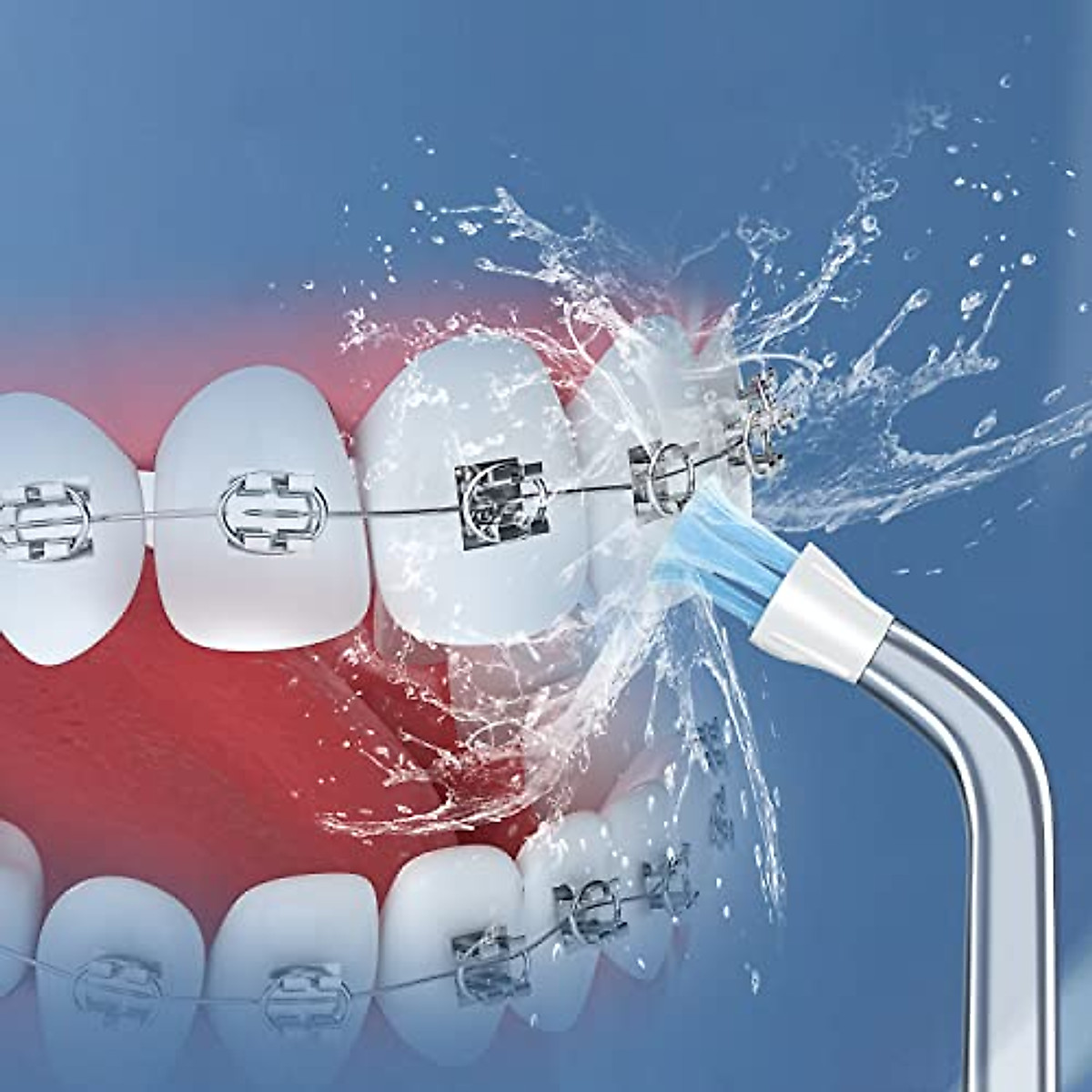 Replacement Tips for Waterpik Water Flosser Classic Jet Tips Waterpik' Replacement Parts and Other Oral Irrigators (AquaFlosser 6 Tips)