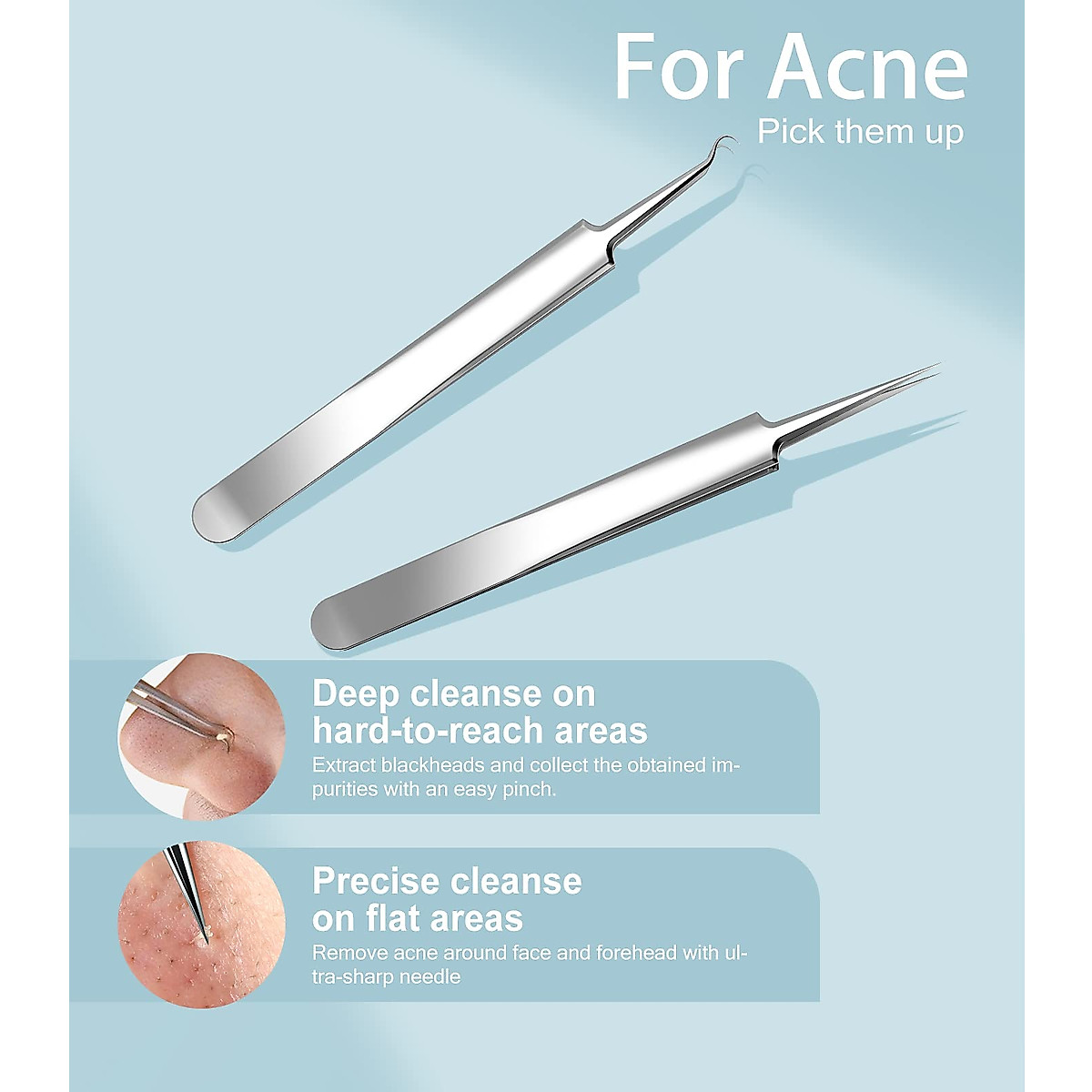 Pimple Popper Tool Kit, Upmore 6PCS Blackhead Remover Professional Stainless Acne Blemish Comedone Extractor Removal Tools with Metal Case and Tweezers for Whitehead Acne on Nose Face