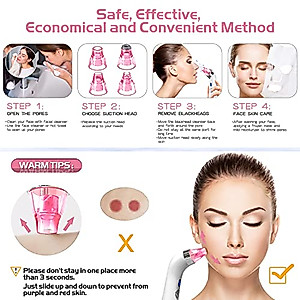 Blackhead remover pore vacuum, Facial Pore Cleaner, Electric Acne Comedone Whitehead Extractor Tool with 5 suction power, 4 probes, Blackhead Remover Suction for Women & Men (Pink)