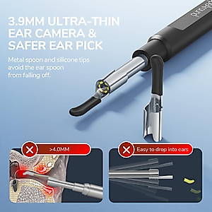 ScopeAround Otoscope Ear Camera, Ear Wax Removal Tool 1080P Otoscope