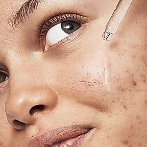 e.l.f. SKIN Blemish Breakthrough Triple-Acid Resurfacing Serum, Hydrating Night Serum For Fighting Acne, Made With Niacinamide, Vegan & Cruelty-Free