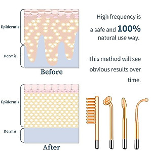 High Frequency Facial Machine - TUMAKOU Portable Handheld High Frequency Facial Skin Wand Machine with 4 Different Tubes