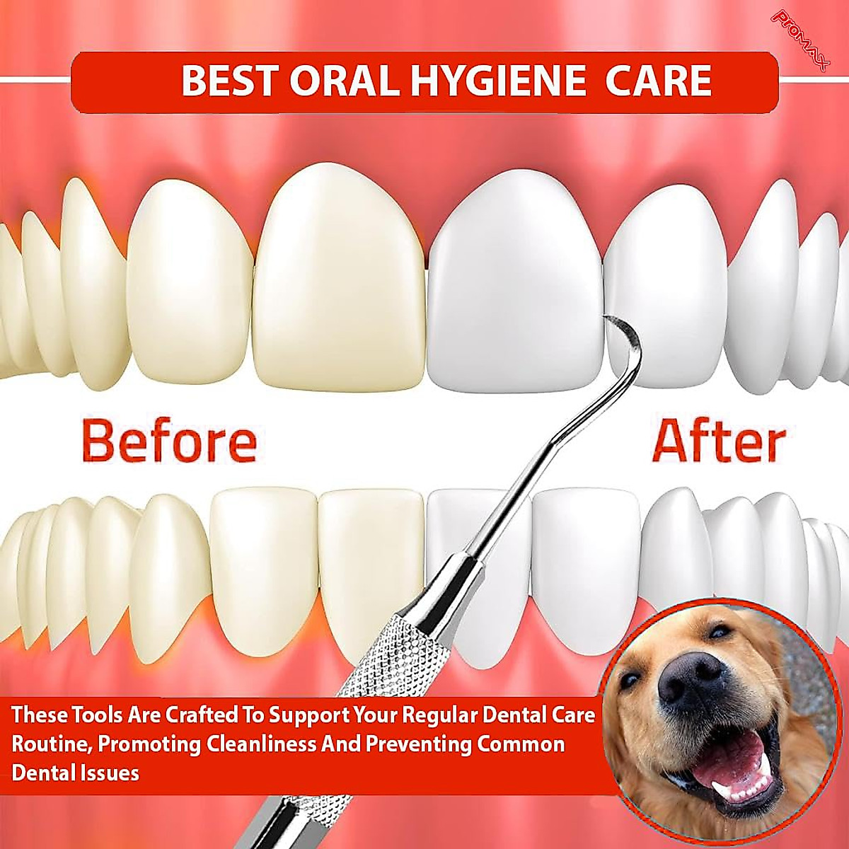 Professional Dental Tartar Scraper Tool - Double Ended Tartar Remover for Teeth, Dental Pick, Plaque Remover, Tooth Scraper - Added Tooth Cleaning at Home - 100% Surgical Stainless Steel-45-10127 (2)