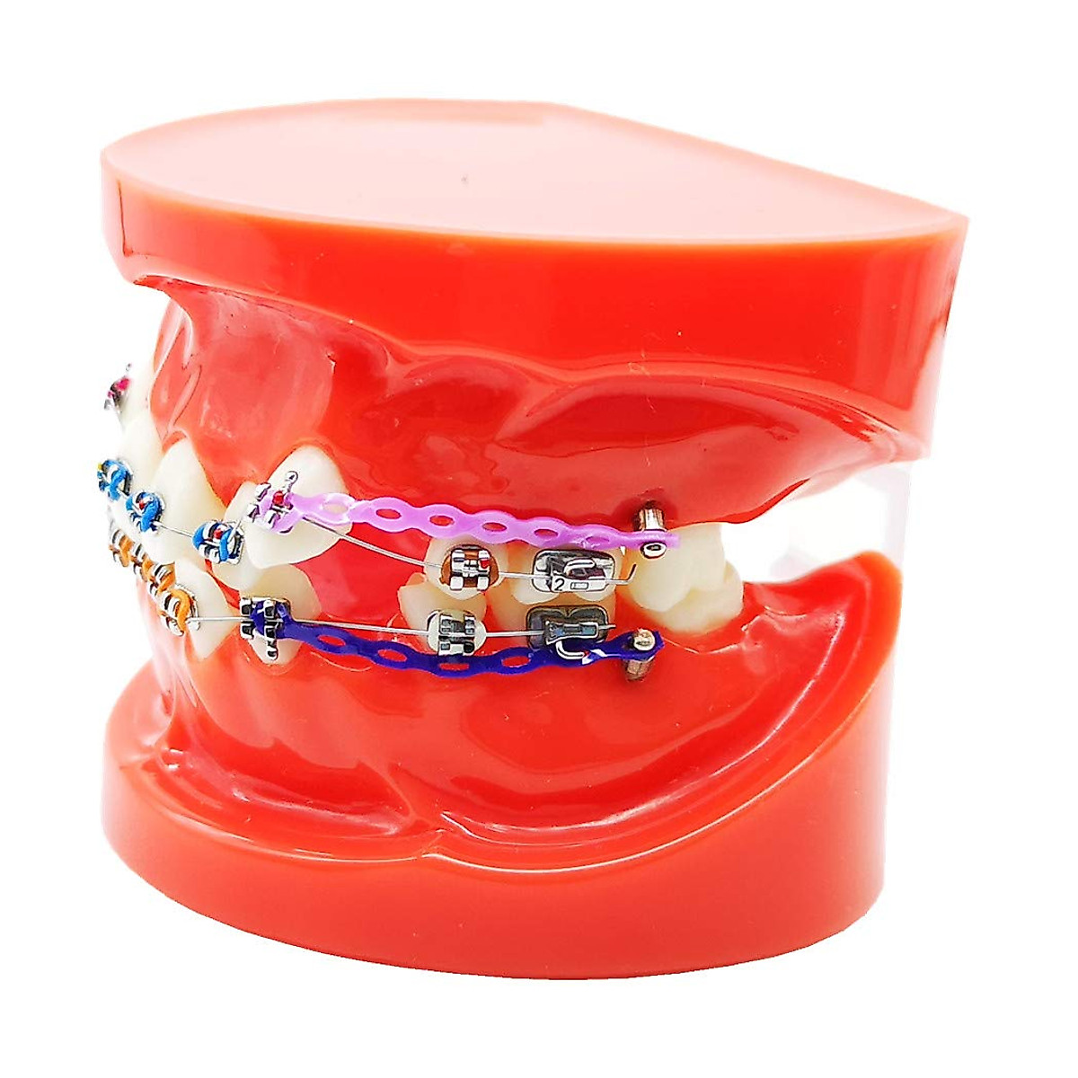 Dental Typodont With Metal Brackets Orthodontic Teeth Model With Ligature Ties Red