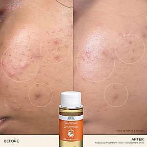 REN Clean Skincare AHA BHA Liquid Exfoliant Tonic for Face - Salicylic & Lactic Acid Exfoliator with Azelaic Acid Precursors, Radiance Exfoliating Toner