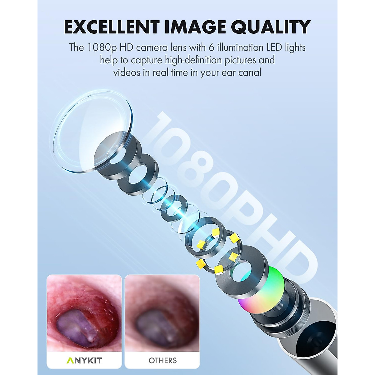 Anykit Digital Otoscope with Gyroscope, HD Ultra Clear View Ear Camera with Ear Wax Removal Tools, Video Ear Scope Otoscope with Light, Compatible with Android, iPhone 15 (White)