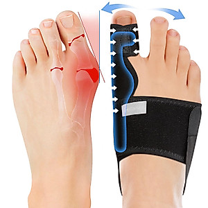 Bunion Corrector Men & Women: 2 Pcs Big Toe Straightener for Bunion Relief - Adjustable Orthopedic Hallux Valgus Corrector for Bunion Splint - Day/Night Support (Black)