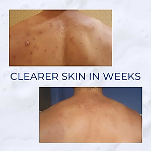 Non-Comedogenic Clear 2 Perfection Shampoo - Sulfate & Paraben-Free for Clear, Healthy Skin & Hair - Esthetician Formulated