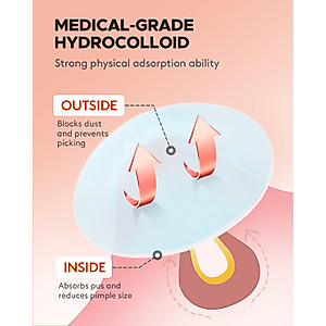 Pimple Patches with Extractor, Hydrocolloid Acne Patches for Face 4 Sizes 176 Count for Zit Breakouts, 2-in-1 Blackhead Remover & Pimple Popper Tool with Tea Tree & Calendula Oil