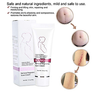 Stretch Mark Cream, Scar Cream Removal Cream Scars Essence Stretch Mark Repair Cream Stretch Scars Remove Acne Cream Stretch Mark Treatment Maternity Repair