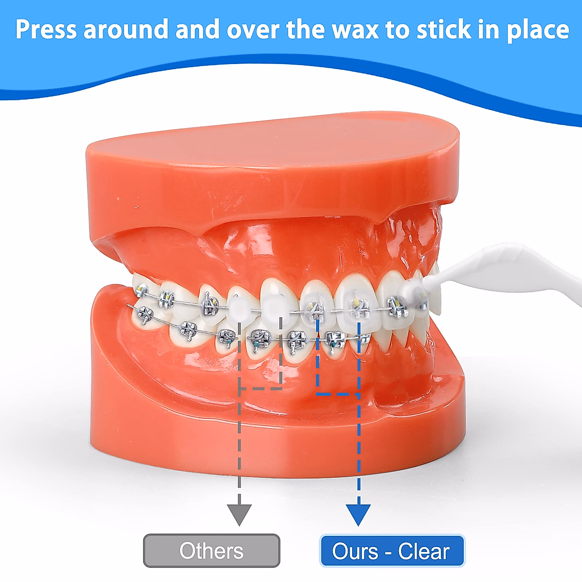 Braces Wax, 10 Pack 50 Precut Wax Strips 350+ Dots, Blue Cases. Includes Storage Box & 2 Applicator Tools, Food-Grade Premium Dental Wax for Braces & Aligners- Stick Better (Mint+Aloe Vera +Vitamin E)