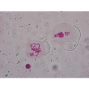 Prepared Animal Plant Cell Mitosis Meiosis Amitosis Comparison Microscope Slides Set, 5pcs Specimens to Display with Students in Biology Class (Mitosis & Meiosis)