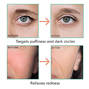 Ice Roller for Face - Smoothes Fine Lines & Wrinkles, Face & Eye Roller for Puffy Eyes, Skin Care Massager, Beauty Gift That Helps Relieve Migraines, Facial & Spa Gifts for Women