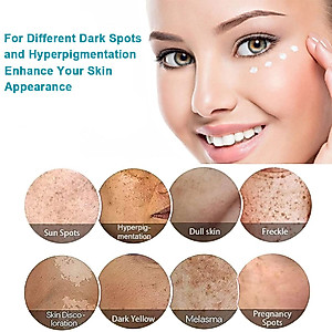 Dark Spot Remover for Face, Fast-Acting Dark Spot Corrector Remover for Face and body Hyperpigmentation, Fades Melasma, Freckle, Sun Spots, Evens Skin Tone, Age Spot Remover for Women Men
