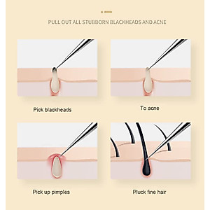ericotry 1Pcs Stainless Steel Pointed Tweezers Ingrown Hair Tweezer Blackhead Remover Splinter Tweezer