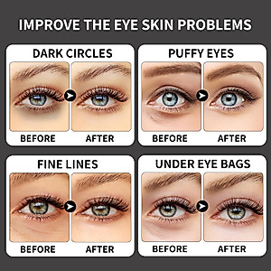 ROUSE Collagen Under Eye Patches with Caffeine Eye Treatment Mask for Dark Circles Eye Fatigue Puffiness Refreshing Revitalizing Skin Care Eye Gel Pads-20 Pairs