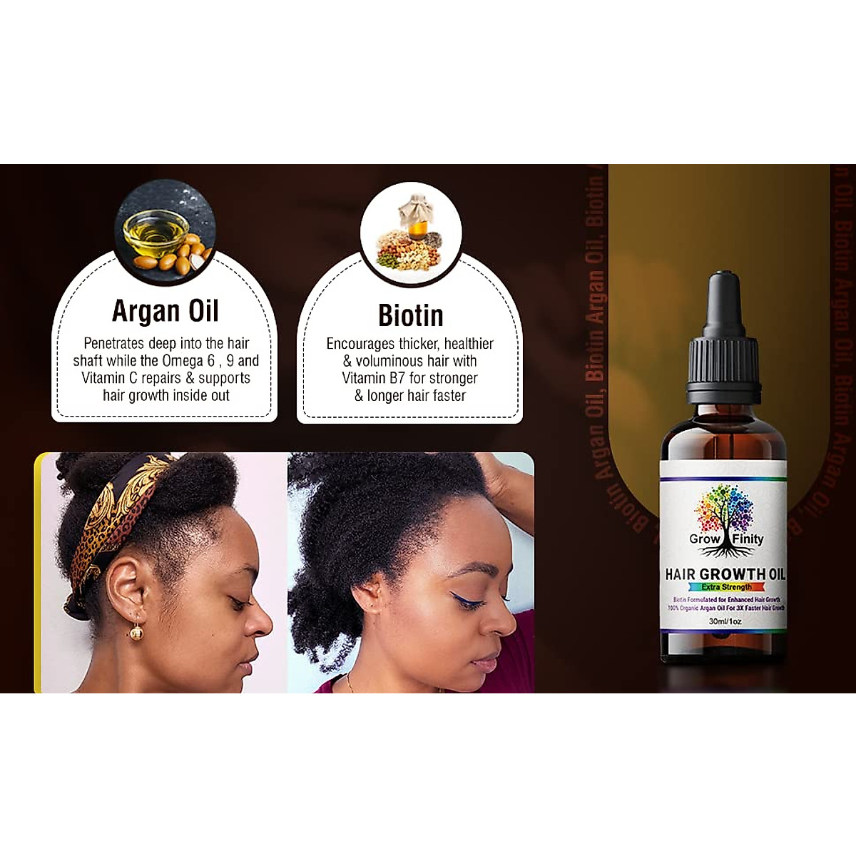 GrowFinity Hair Growth Oil | Biotin and Argan Infused for 3x Faster Growth | Regrowth Treatment | Vitamin E Salon-Grade Natural Oil - 1 Oz