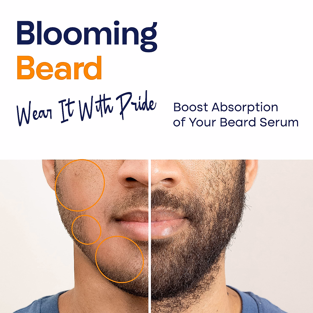 Derma Roller for Face - Beard Roller for Men - Scalp Roller for Men - Microneedle Roller - 0.3mm - Carrying Case Included - Skin Micro Needling Roller For HIM