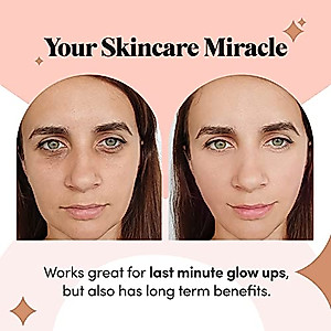 Rose Golden Under Eye Collagen Gel Mask - Bright Eyes Anti Aging Treatment For Dark Circles, Puffy Eyes, Bags, Fine Lines - 30 Pairs (60 Total Rose Gold Patches)