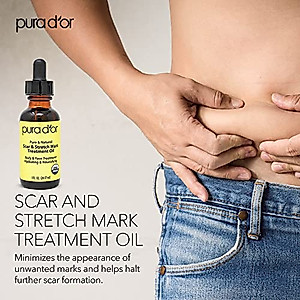 PURA D'OR Organic Scar & Stretch Mark Treatment Oil (1oz) For Skin - With Rosehip, Wheat Germ, Argan, Tamanu, Carrot, Rosemary, Lavender, Geranium, Patchouli, Sage