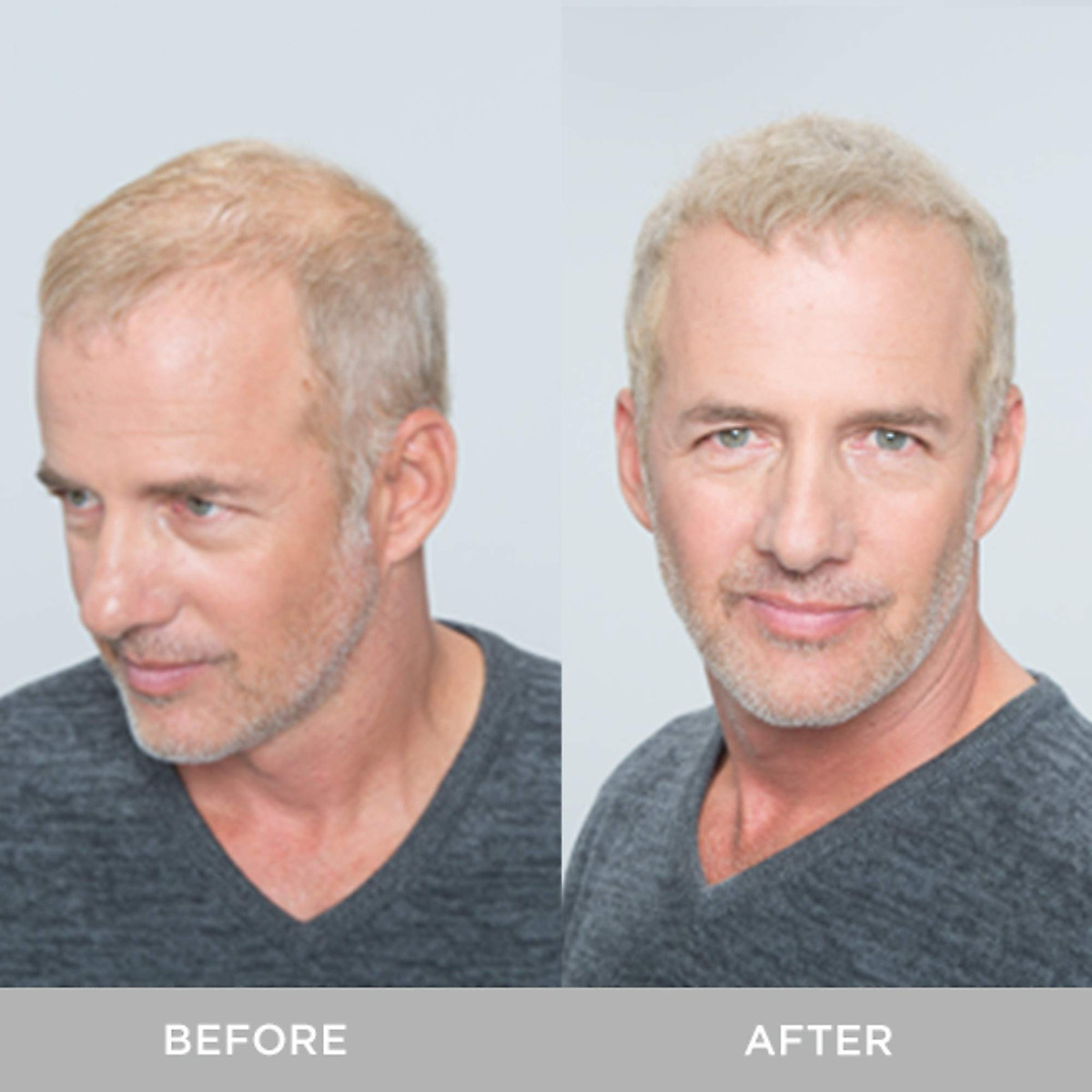 XFusion Keratin Hair Fibers - Medium Brown (3g Travel Size)