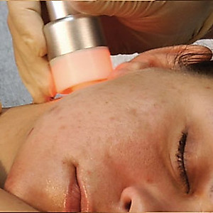 Microdermabrasion: Crystal-Free Techniques DVD - Learn How To Use a Microderm Machine In This Skin Care Training- Learn Cosmetic Procedures For a Complete Skin Rejuvenation Facial Treatment - Won A Telly Award - Best Video (2 Hrs. 7 Mins.)