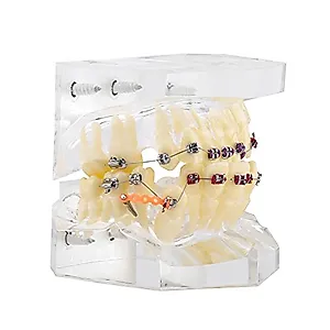 Teeth Educational Model Dental Treatment Malocclusion Study Demonstration Teeth Model with Wire Chain Orange
