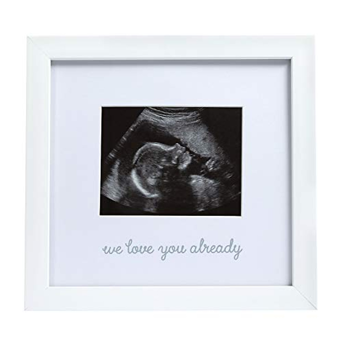 Little Pear We Love You Already Sonogram Frame, Gender-Neutral Pregnancy Announcement Picture Frame, Mother’s Day Keepsake Photo Frame, Nursery Décor, White