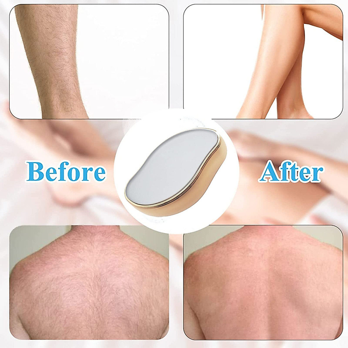 Dormencir Crystal Hair Eraser, Crystal Hair Eraser, Painless Exfoliating Magic Crystal Hair Remover, Quick & Easy Hair Removal Tool for Men & Women Arms Legs Back, Gold