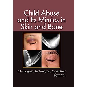 Child Abuse and its Mimics in Skin and Bone